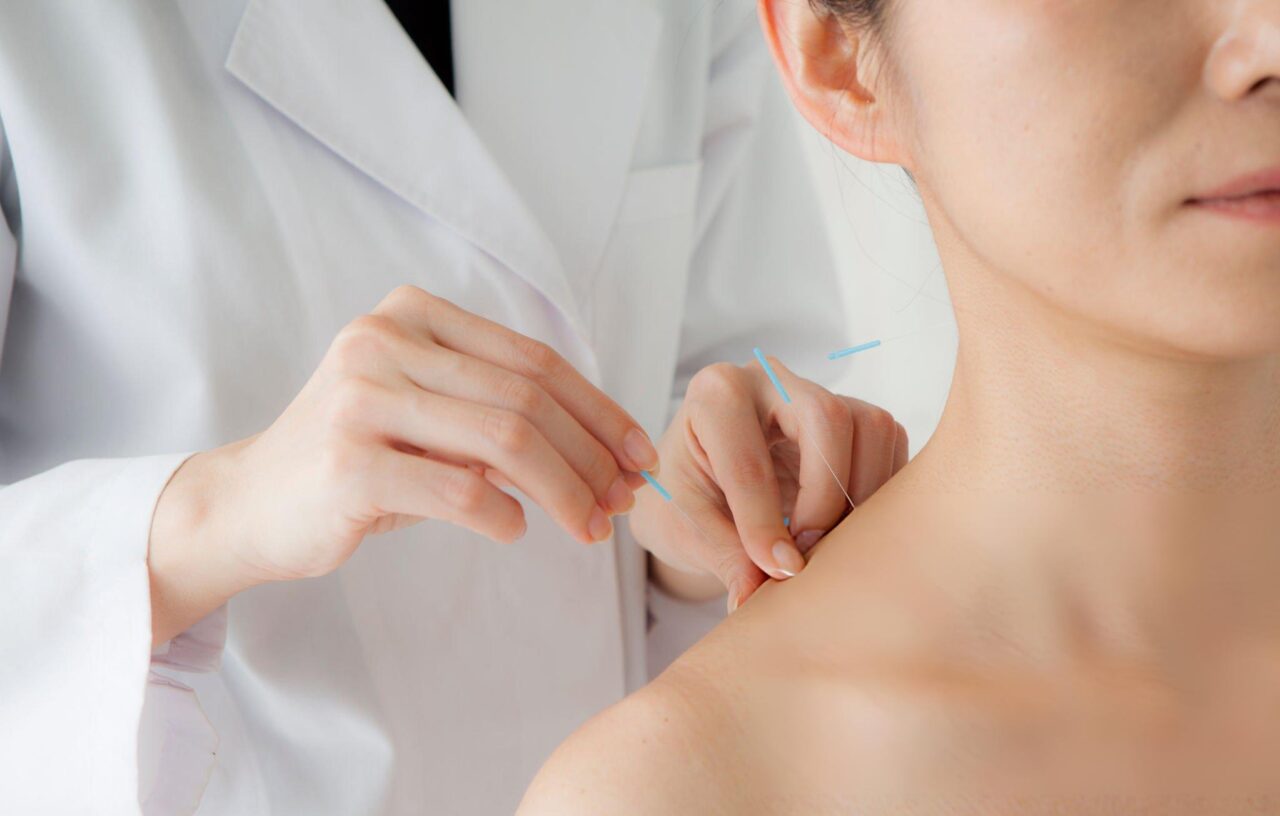 Gentle Acupuncture for Shoulder Pain Relief